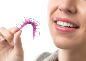 Retainer Braces - Apa Anda Perlu Tahu?